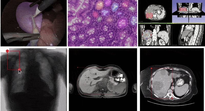 The Ultimate Guide to Medical Image Segmentation with Deep Learning (2D ...
